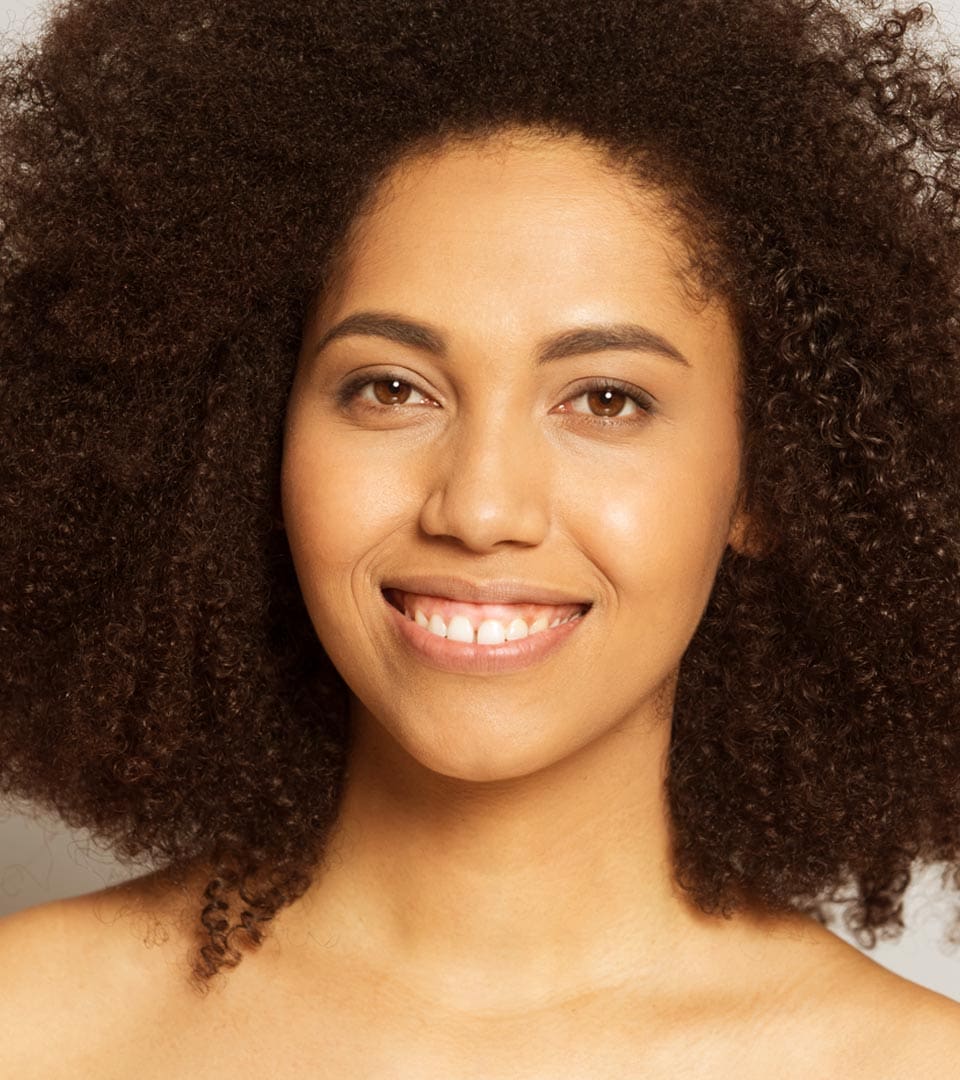 Gummy Smile | Square Mile Dental Centre | London Dental Care